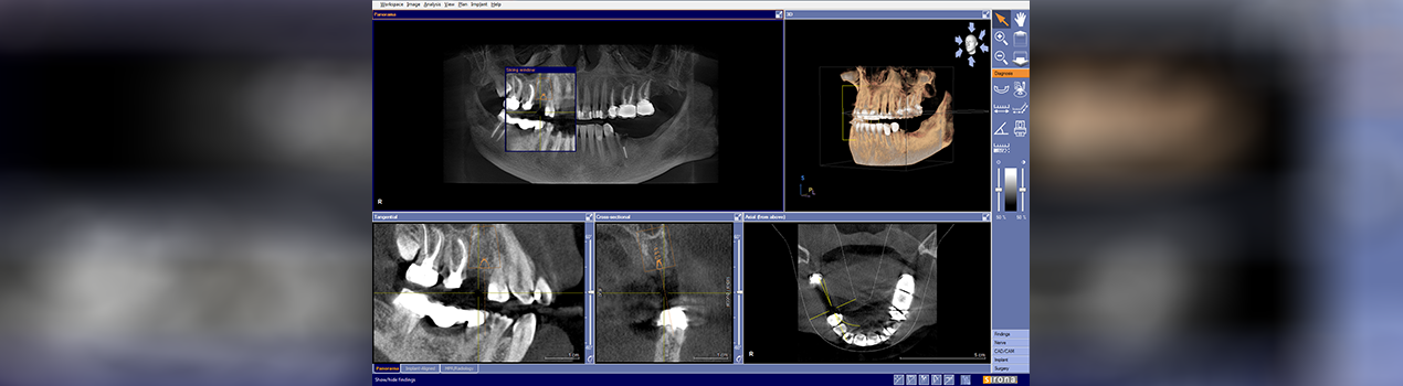 CBCT - [EN] Clinica dentara Trident