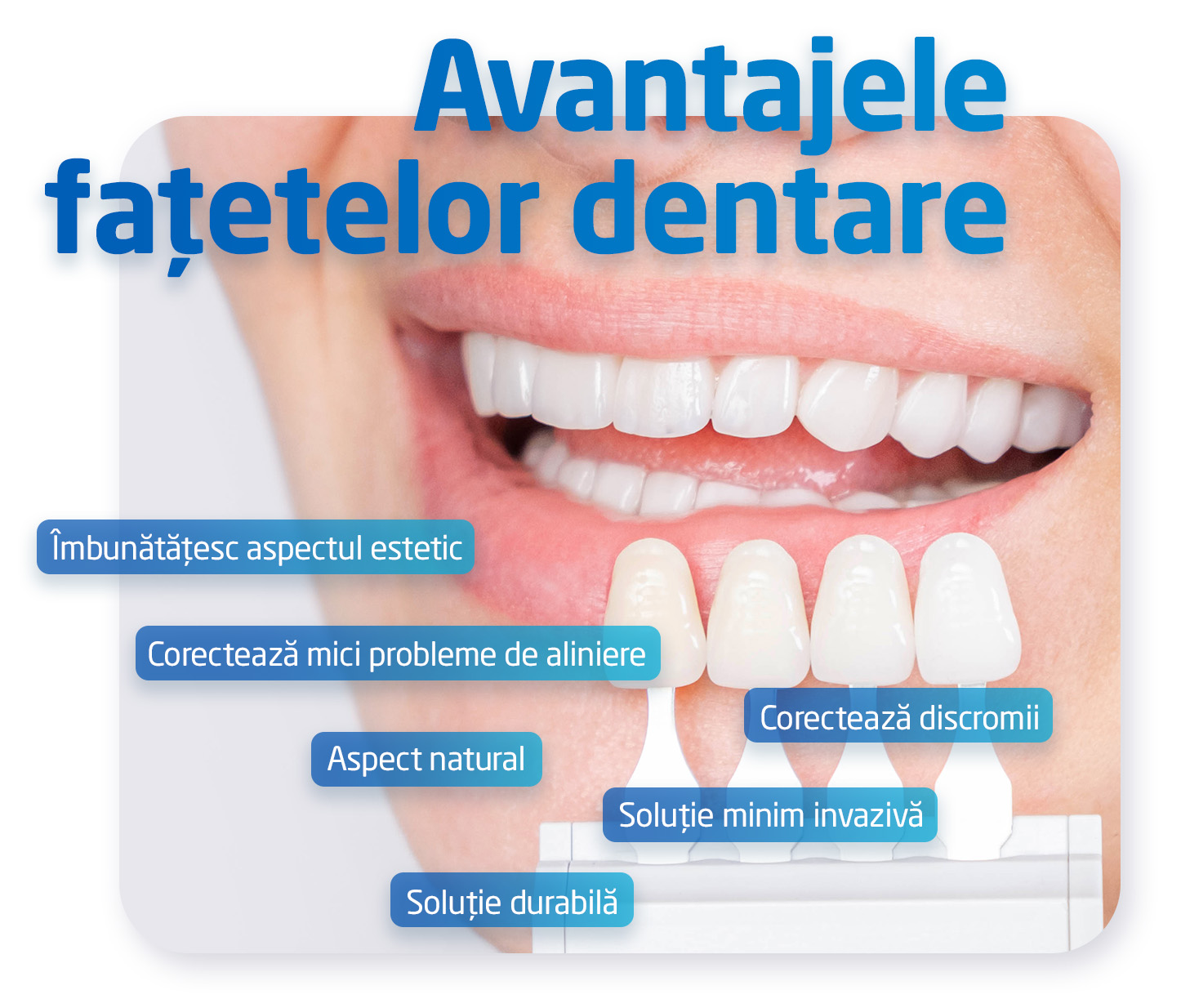 Fațete Dentare | Trident Bucuresti