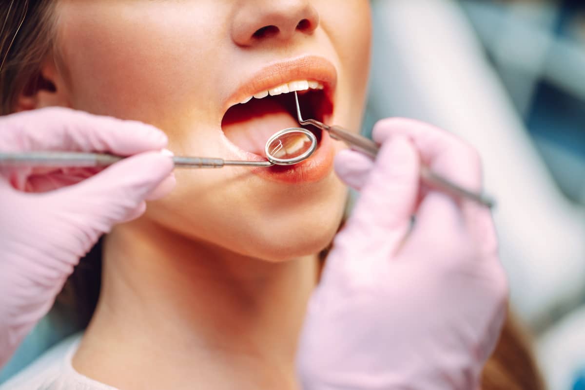 Tartru subgingival. Cauze, simptome și tratament | Clinica Trident